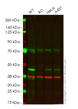 Anti-15-PGDH antibody [EPR14332-19] - BSA and Azide free (ab232625) | Abcam
