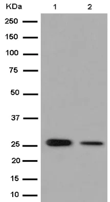 Anti-15-PGDH antibody [EPR14332-19] - BSA and Azide free (ab232625) | Abcam