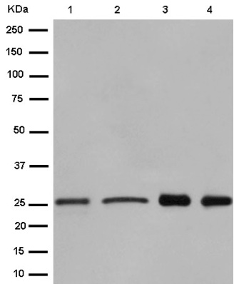Anti-15-PGDH antibody [EPR14332] (ab187160) | Abcam