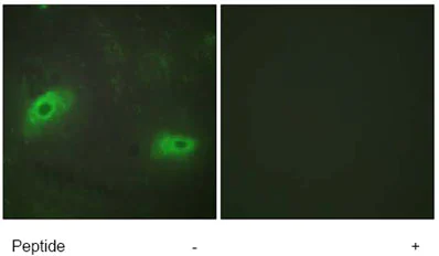 Anti-4-1BBL antibody (ab64912) | Abcam