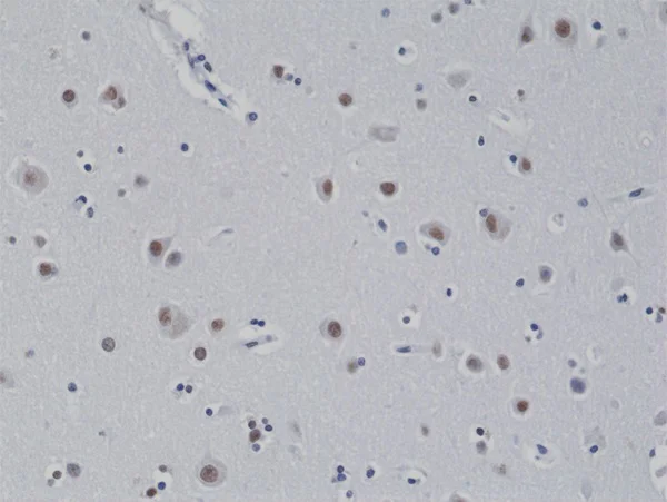 Anti-5-methylcytosine (5-mC) antibody [RM231] (ab214727) | Abcam