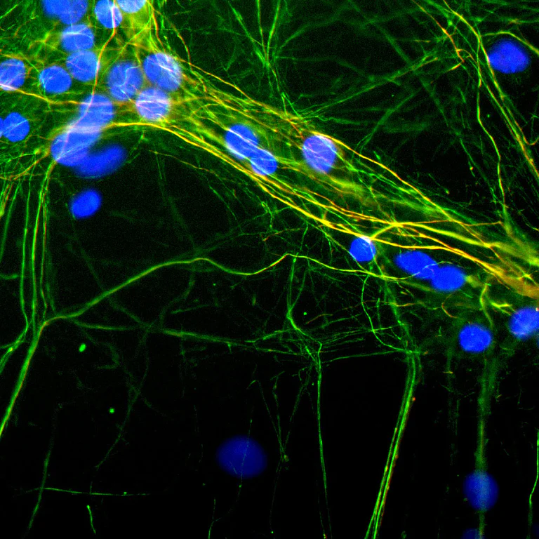 68kDa Neurofilament/NF-L抗体 (ab9035)| Abcam中文官网