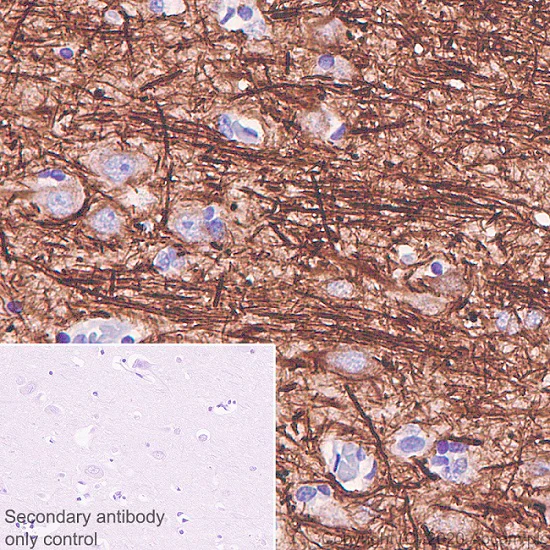 68kDa Neurofilament/NF-L抗体[NfL23] (ab273442)| Abcam中文官网