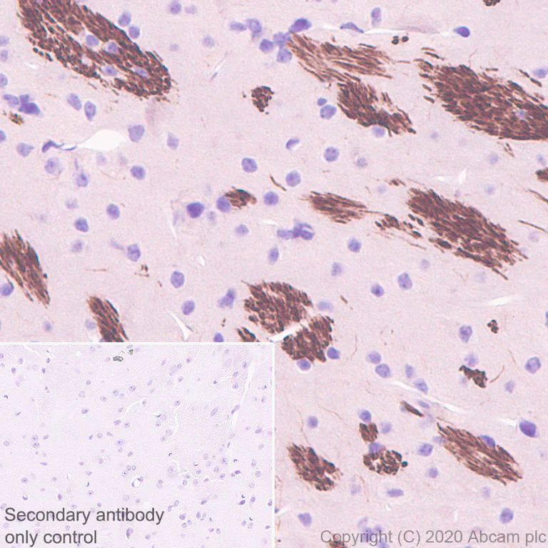 68kDa Neurofilament/NF-L抗体[NfL23] - BSA and Azide free (ab273480 ...