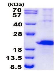 Recombinant Human TIM 3 protein (denatured)(AB139246)