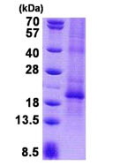 Recombinant Human Chorionic Gonadotropin protein (denatured)(AB140723)