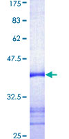 Recombinant Human TdT protein(AB152345)