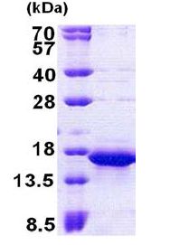 Recombinant Human TOMM20 protein(AB156966)