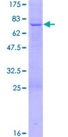 Recombinant Human SERPINE2/PN-1 protein(AB159115)