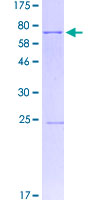 Recombinant Human SGCE/ESG protein(AB160261)