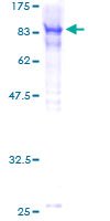Recombinant Human TOX protein(AB160644)