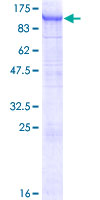 Recombinant Human FBXO42 protein(AB162741)