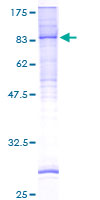 Recombinant Human CLPTM1L protein(AB164317)