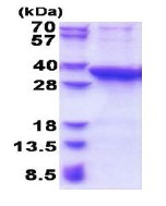 Recombinant Human PROSC protein(AB180345)