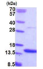 Recombinant Human AAMDC protein(AB187473)