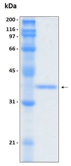 Recombinant Human KAL1 protein (His tag)(AB204766)