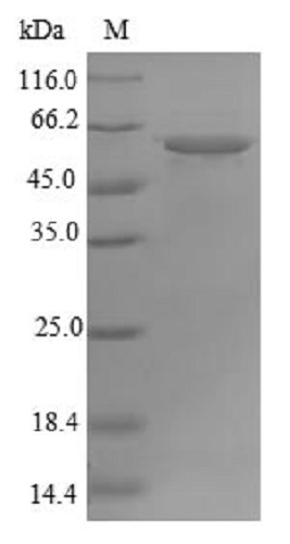 Recombinant Human ATP5A protein (His tag)(AB235862)
