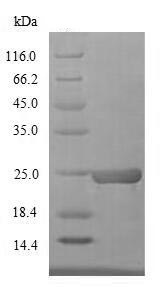 Recombinant Miraculin protein (His tag)(AB235869)