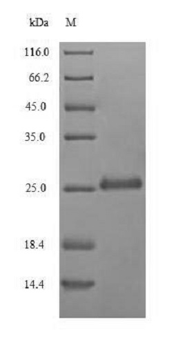 Recombinant Ribonuclease U2 protein(AB237556)