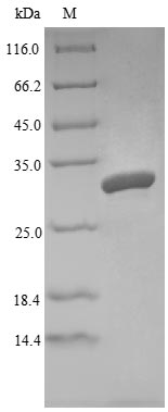 Recombinant Mouse Angiogenin-4 protein (Tagged)(AB238236)