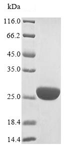 Recombinant RNA directed RNA polymerase L protein (His tag)(AB239435)