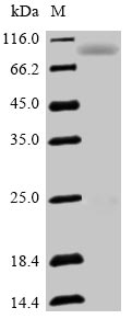 Recombinant Human Semaphorin 3F protein (His tag)(AB267845)