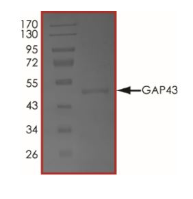 Recombinant Human GAP43 protein (His tag)(AB268592)
