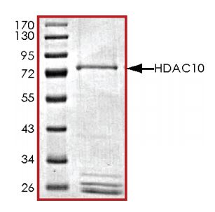 Recombinant human HDAC10 protein (Active)(AB268611)
