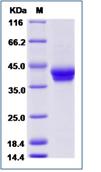 Recombinant Human GGH protein (His tag)(AB276455)