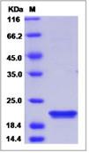 Recombinant Human Centrin 2 protein (His tag)(AB276631)