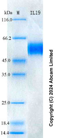 Recombinant Mouse IL-19 Protein Standard (His tag)(AB322098)