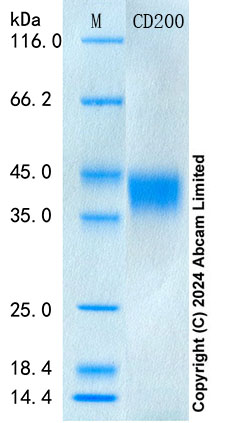 Recombinant Human CD200 Protein Standard (His tag)(AB322755)