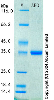 Recombinant Human ABO Protein Standard (His tag)(AB322756)
