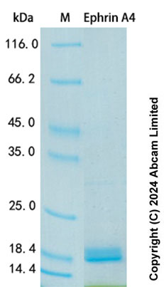 Recombinant Human Ephrin A4 Protein Standard(AB322764)