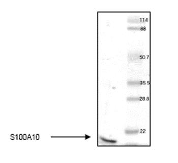 Recombinant Human S100A10 protein(AB55671)