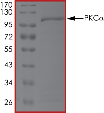 Recombinant X. laevis PKC alpha protein(AB60839)