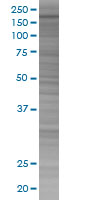 ADAR1 overexpression 293T lysate (whole cell)(AB94050)