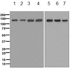 Anti-ABL1 + ABL2 antibody [EPR1222(2)] (ab134134) | Abcam