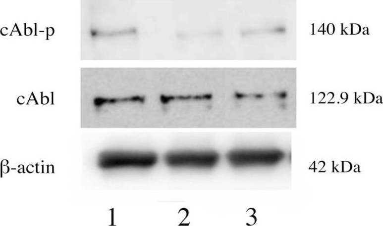 Anti-ABL1 (phospho Y412) antibody (ab4717) | Abcam
