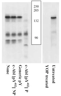 Anti-ABL1 (phospho Y412) antibody (ab4717) | Abcam