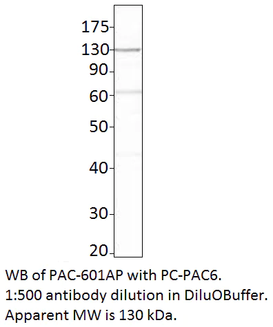 Anti-AC6 antibody (ab14781) | Abcam