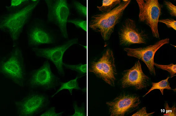 Anti-Acetylcholinesterase 抗体 [HL1102] - BSA and Azide free (ab313828)