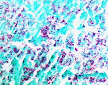 Acid Fast Bacteria (AFB) Stain试剂盒(Microorganism Stain) (ab150660 ...