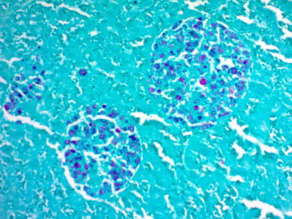 Acid Fast Bacteria (AFB) Stain Kit (Microorganism Stain) (ab150660) | Abcam