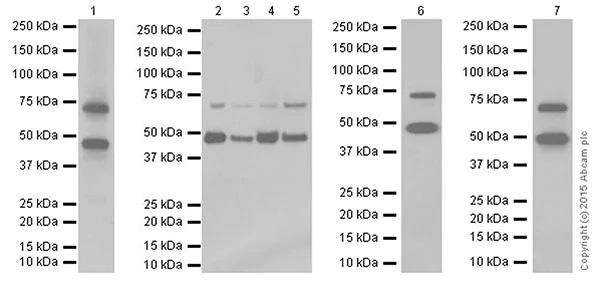 ACOX1/AOX抗体[EPR19038] (ab184032)| Abcam中文官网