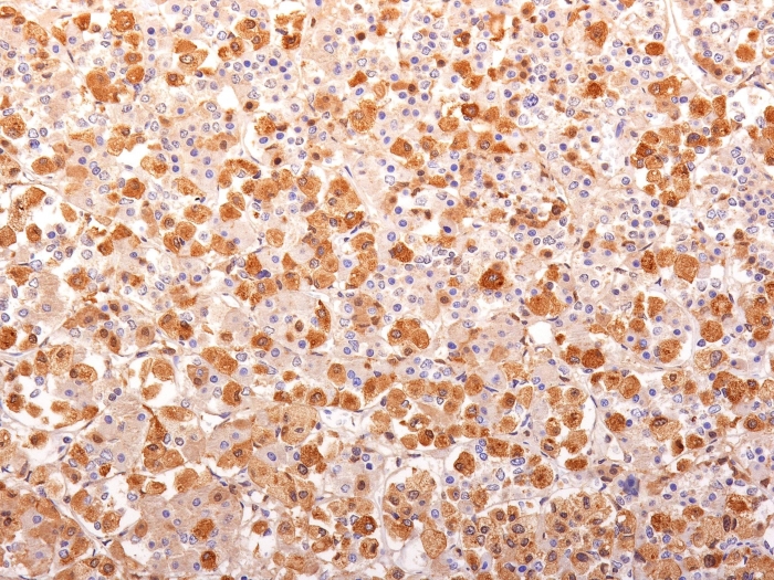 Anti-ACTH antibody [AH26 + 57] - N-terminal (ab199007) | Abcam