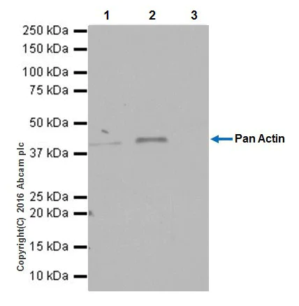 Anti-Actin antibody [EPR19353-16] - Loading Control (ab216070) | Abcam