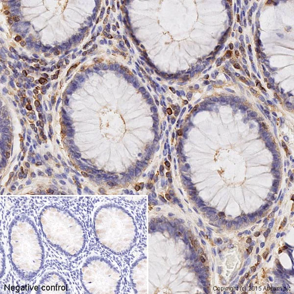 Anti-Actin antibody - Loading Control (ab1801) | Abcam