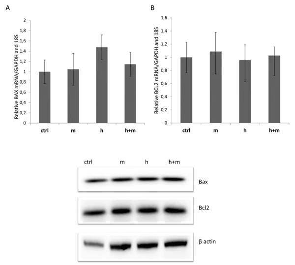Anti-Actin antibody - Loading Control (ab1801) | Abcam