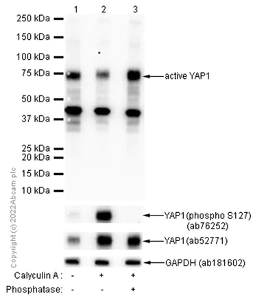Anti-active YAP1 antibody [EPR19812] - recombinant (ab205270) | Abcam